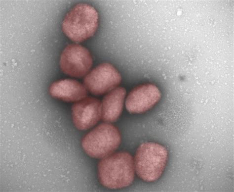 El Virus De La Viruela Del Mono Podría Transmitirse También Por Vía