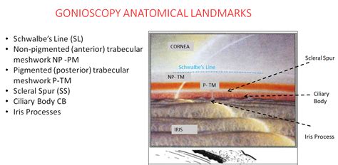 Iris Processes Gonioscopy