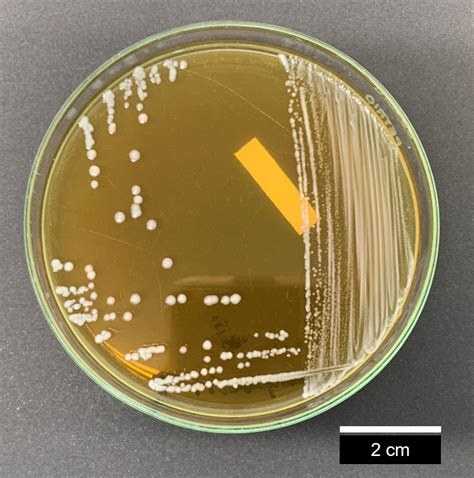 Lactobacillus Fermentum Jesús Ballesteros Free Download Borrow