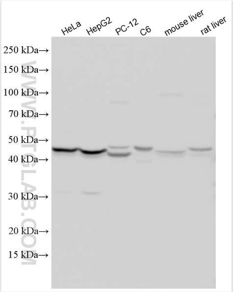 Steap3 Antibody 28478 1 Ap Proteintech