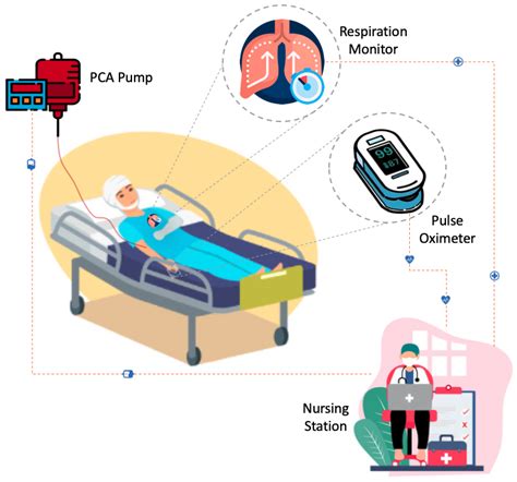 A Clinical Use Case Of Opioid Infusion Monitoring Download Scientific