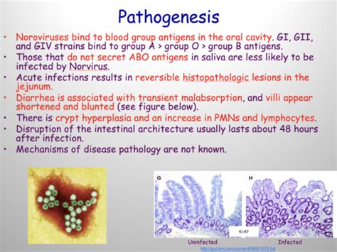 Norovirus Flashcards Quizlet