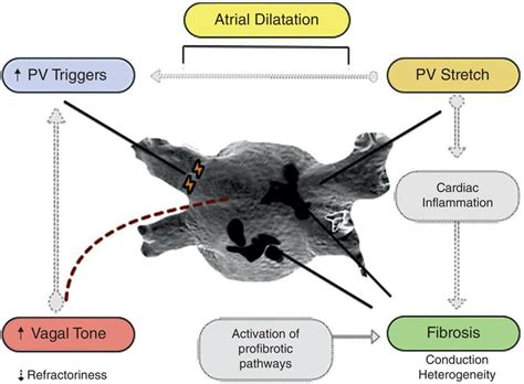 13 Atrialflutter Fibrillation Thoracic Key