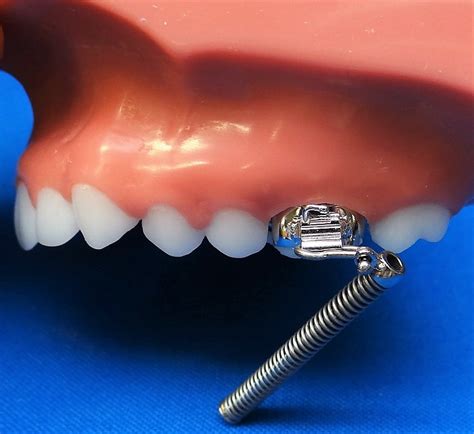 Xbow Class Ii Corrector Specialty Appliances