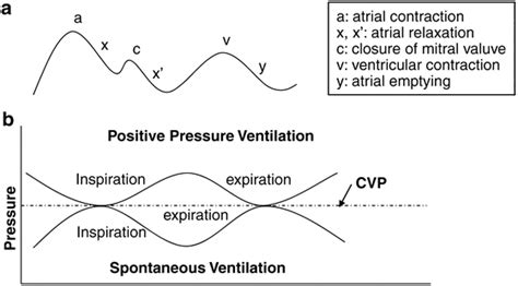 Monitoring In The Intensive Care Unit Anesthesia Key
