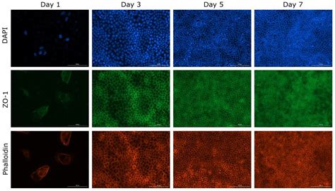 Cellular Fluorescence Imaging With Millicell® Cell Culture Inserts