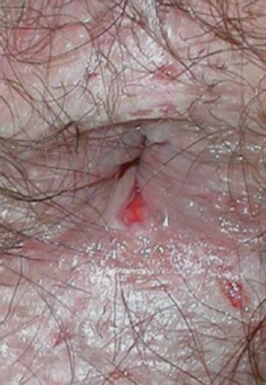 Gsc Gaurav Surgical Clinic