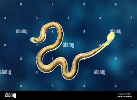 Elephantiasis Icd 10 Code
