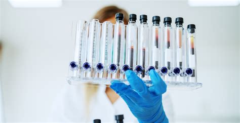 Vancomycin Renal Dose Renal Function Impact Body Weight