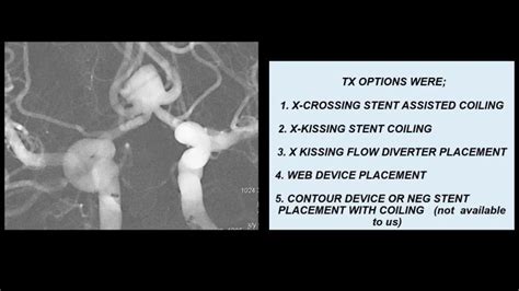New Case Wide Necked Com Aneurysm With Microvention Terumo World Live Neurovascular