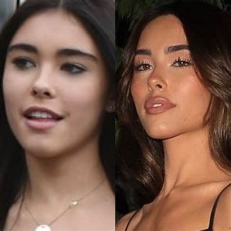 Madison Beer Plastic Surgery 2022 Madison Beer Transformers