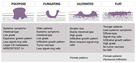 Are Borrmanns Types Of Advanced Gastric Cancer Distinct