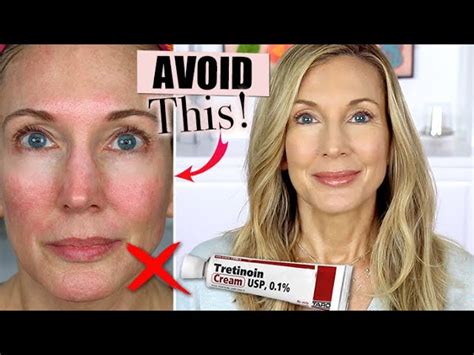 Tretinoin Cream Before And After
