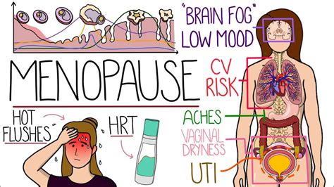 Menopause Explained Clearly Includes Hrt And Perimenopause Youtube