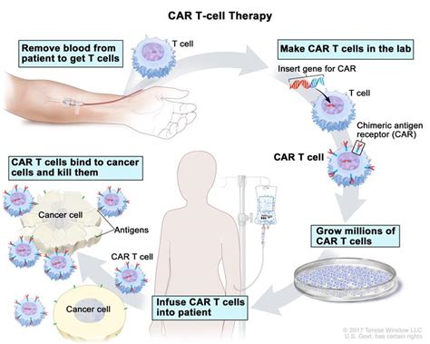 Car T Cell Therapy Chimeric Antigen Receptor Therapy Rutgers Cancer