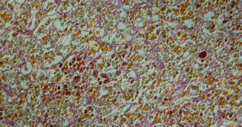 Pituitary Gland In Cross Section Stock Footage Video Of Examination