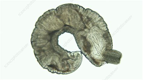 Echinorhynchus Gadi Parasitic Worm Light Microscopy Stock Video Clip