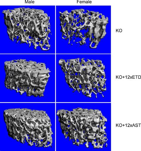 Bone Microarchitecture In Male And Female Abcc6 Mice Ko Treated