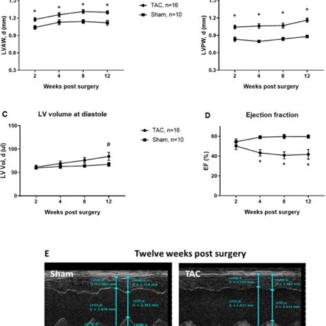 Echocardiogram Characterization Following Transverse Aortic