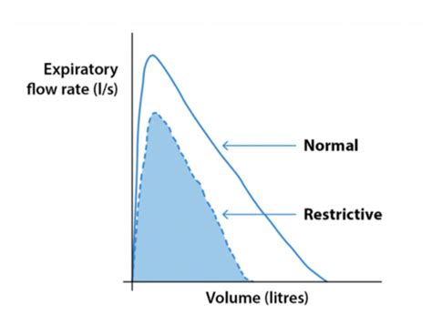 Approach To Pft Flashcards Quizlet