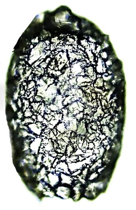 Difflugia Sp 4 Tecamebas