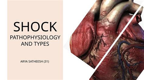 Pathophysiology And Types Of Shock Mbbspptx