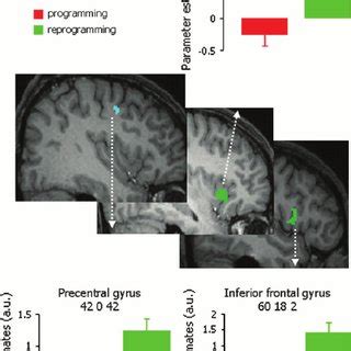 Imaging Dataright Frontal Cortex Anatomical Location SPM T S Of Download Scientific