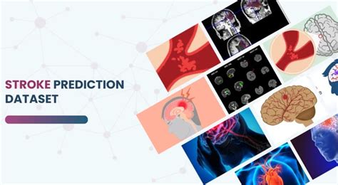 stroke prediction dataset predict stroke risk with data