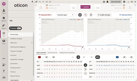Oticon Genie 2 20252 Download Hearing Aid Software