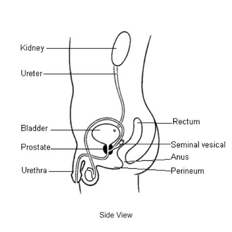 Prostate Surgery Patients Robotic Prostate Surgery