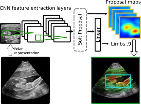 Overview Of Our Framework A Fetal Ultrasound Image Is Processed In Download Scientific Diagram