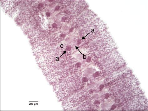 Senga Rostellarae Showed Mature Proglottid A Ovary B Isthmus C