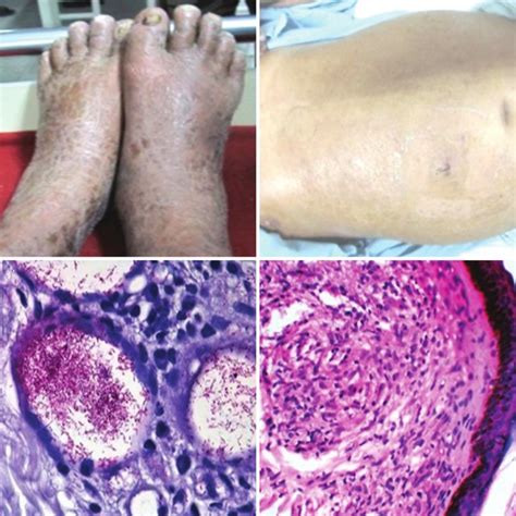 Sun Classification Of Cells And Flare Download Table