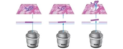 Laser Capture Microdissection Precision In Cellular Analysis