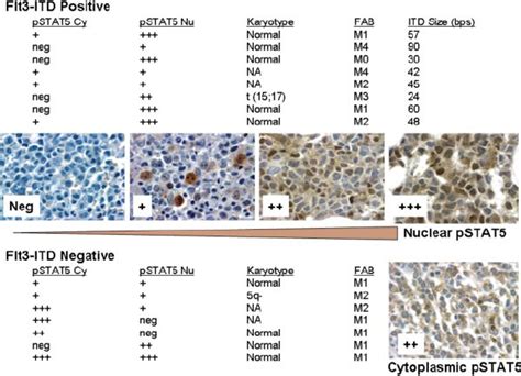 Relationship Between Flt3 Itd Status And Distribution Of Phospho Stat5