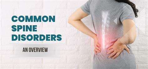 Common Spine Disorders An Overview Ezine Articles