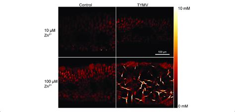 µxrf Tomography Of Zn Distribution In Fully Developed N Ochroleucum