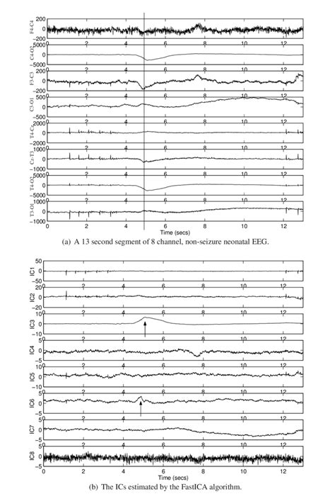 7 the fastica algorithm applied to non seizure neonatal eeg the eeg