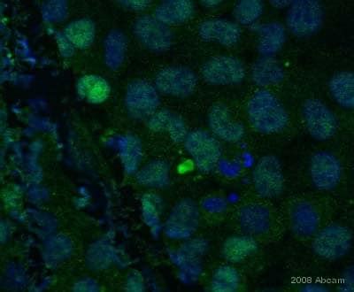 Anti RUNX2 Antibody Ab23981 Abcam