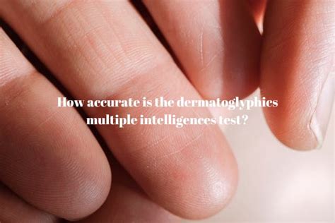 How Accurate Is The Dermatoglyphics Multiple Intelligences Test Dmit