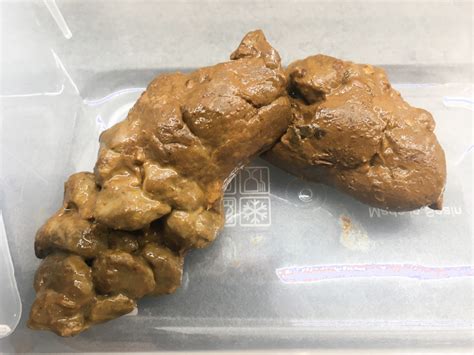 My Turd Image 3446277 Thisvid Tube