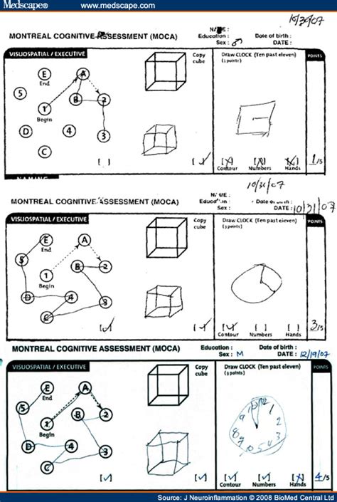 Parallel Versions Of The Moca Cognitive Assessment Rayfeti
