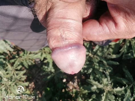 My Dick2 5 Pics Xhamster