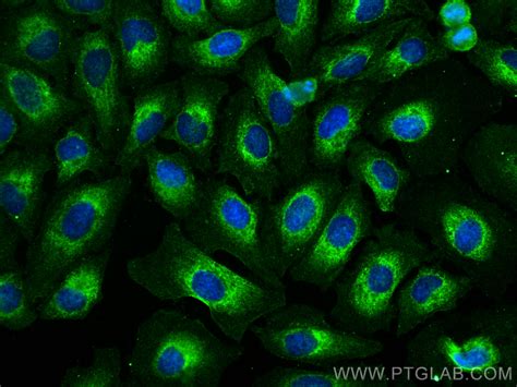 Usp36 Antibody 68165 1 Ig Proteintech