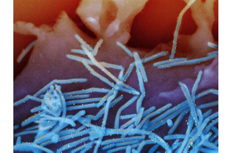 接种新rsv疫苗的美国老年人中，罕见神经系统疾病的报告“比预期的更常见” 疫苗网