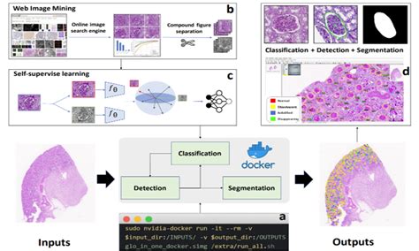 Glo In One Holistic Glomerular Detection Segmentation And Lesion Characterization With Large