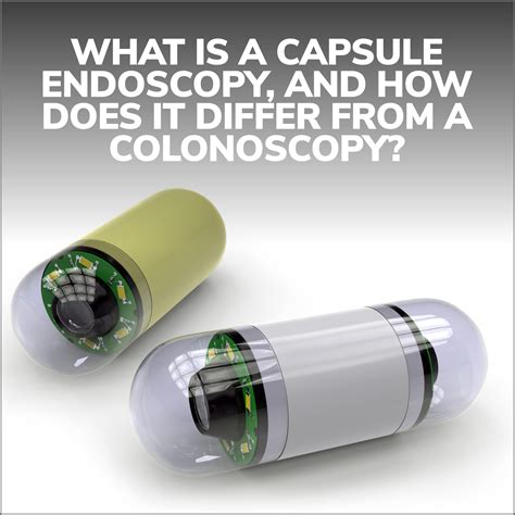 Endoscopy And Colonoscopy Together At Kim Jean Blog
