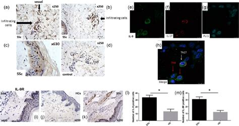Interleukin Il 9 And Il 9r Expression In The Skin Of Systemic