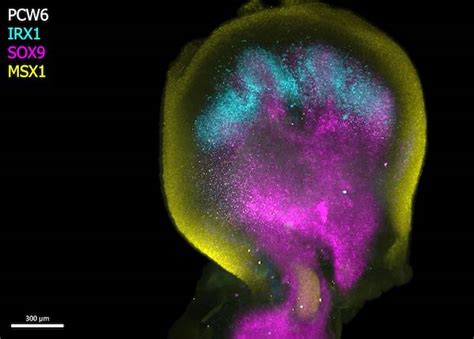 First Remarkable Mapping Of Limb Development Shows Stages Of Creating
