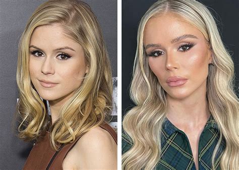 Celebrity Plastic Surgery Before And After Reddit